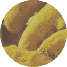 Gout Treatment - Find Relief with Urcinol | PurMEDICA